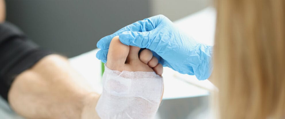 Treating Venous Ulcers | Center for Wound Care