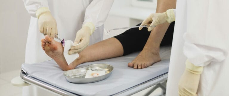 Debridement | Center for Wound Healing and Hyperbaric Medicine
