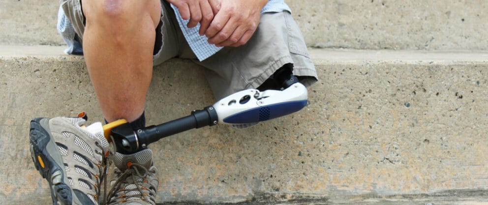 Limb Preservation | Center for Wound Healing and Hyperbaric Medicine