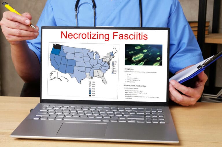 Necrotizing Fasciitis | Center for Wound Healing and Hyperbaric Medicine